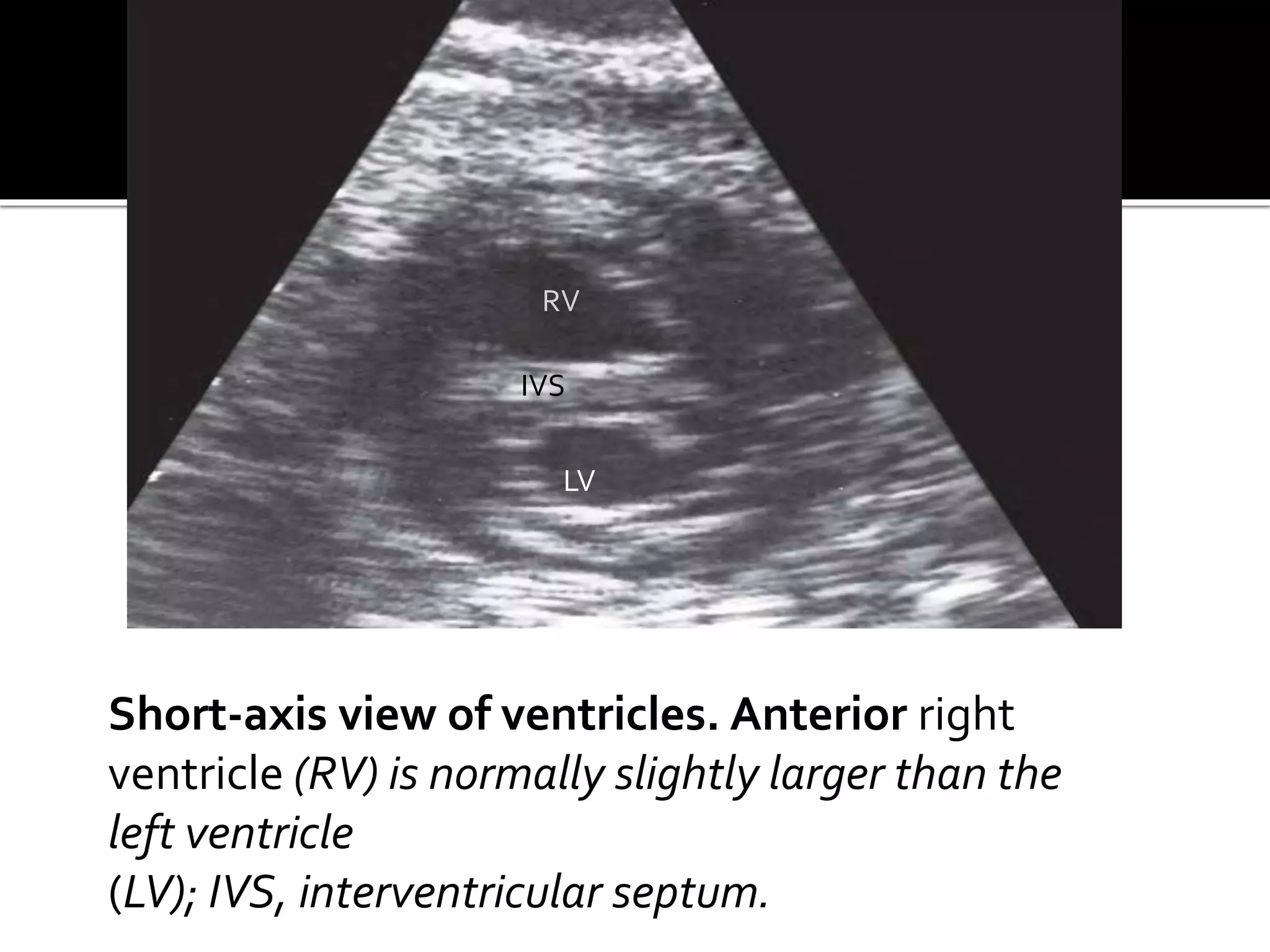 The fetal heart | PPTX