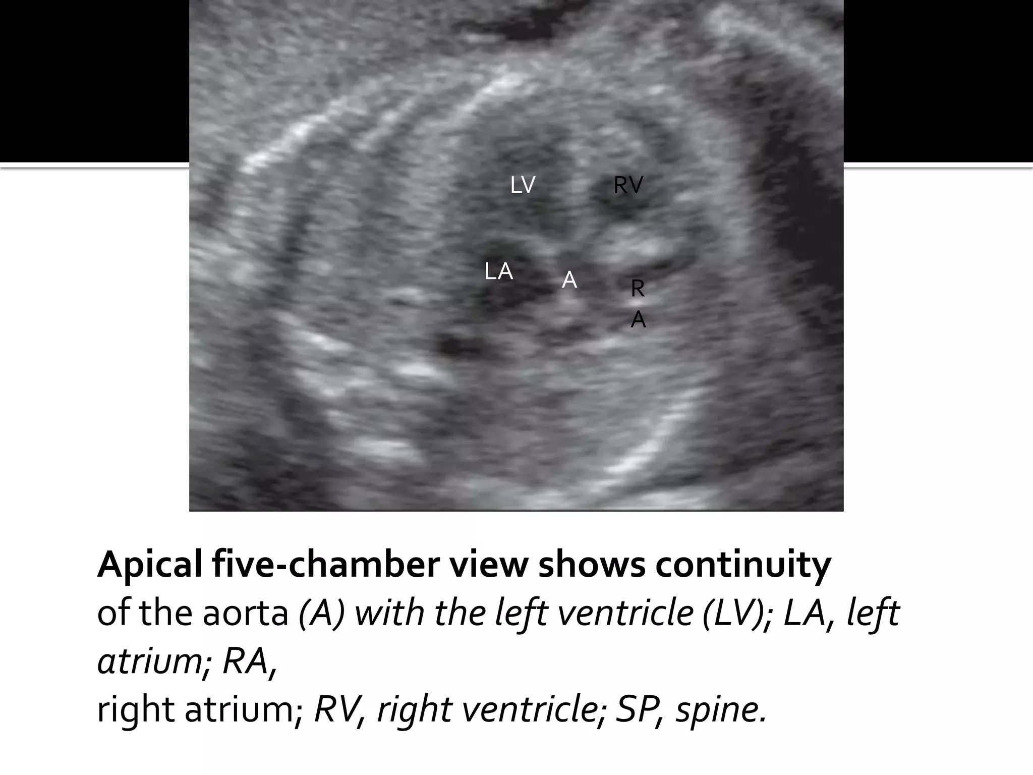 The fetal heart | PPTX