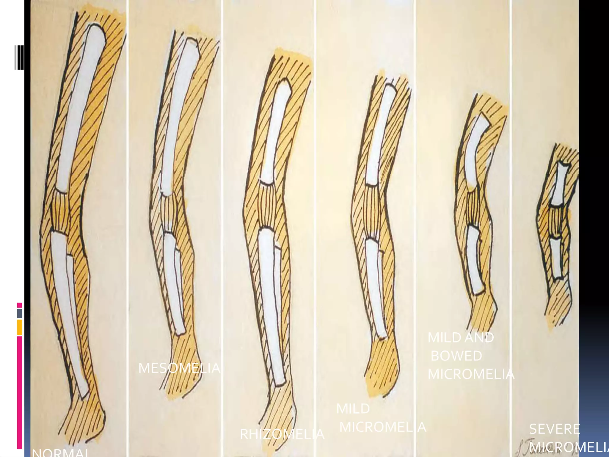 The fetal musculoskeletal system | PPTX
