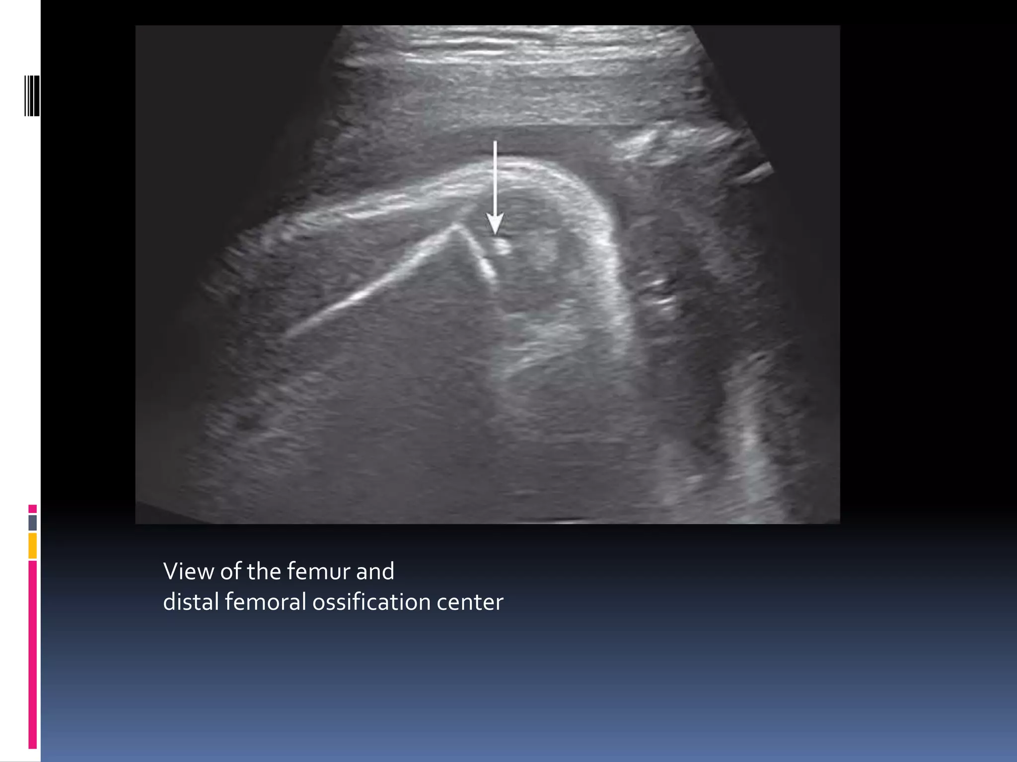The fetal musculoskeletal system | PPTX