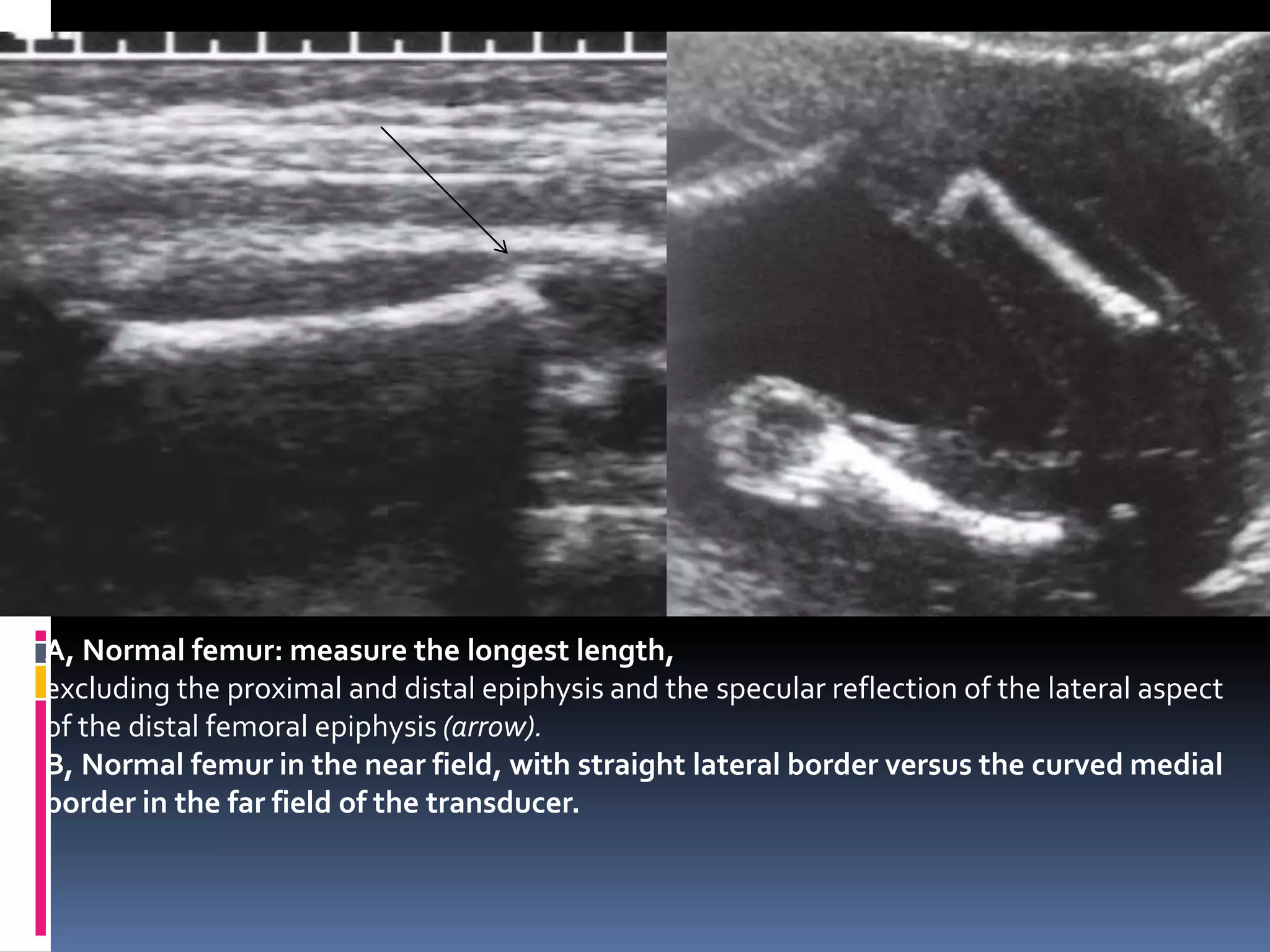 The fetal musculoskeletal system | PPTX