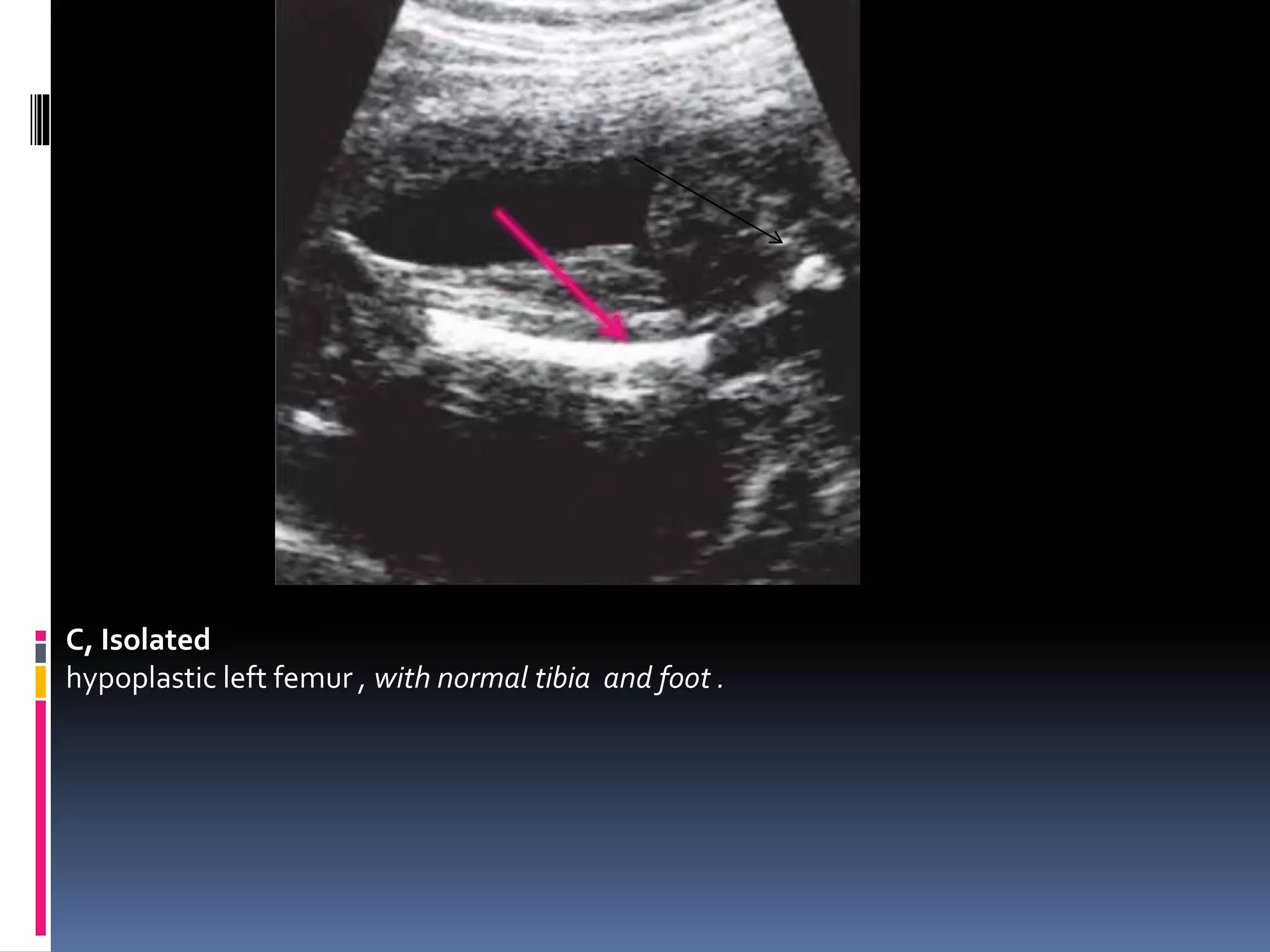 The fetal musculoskeletal system | PPTX