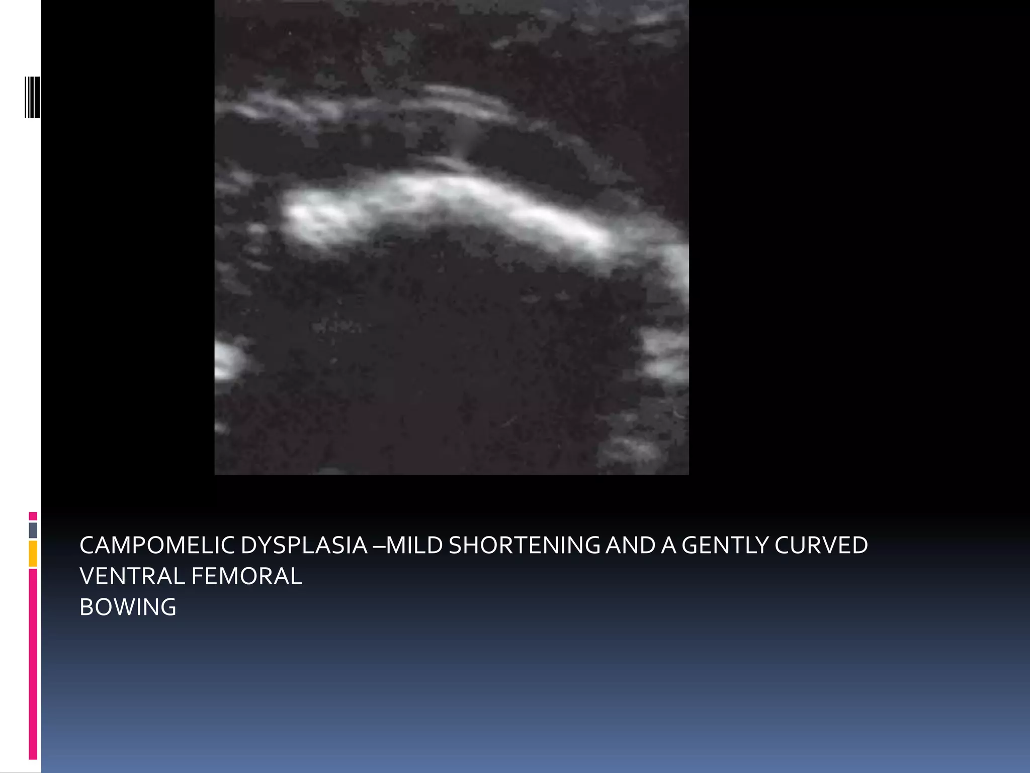 The fetal musculoskeletal system | PPTX
