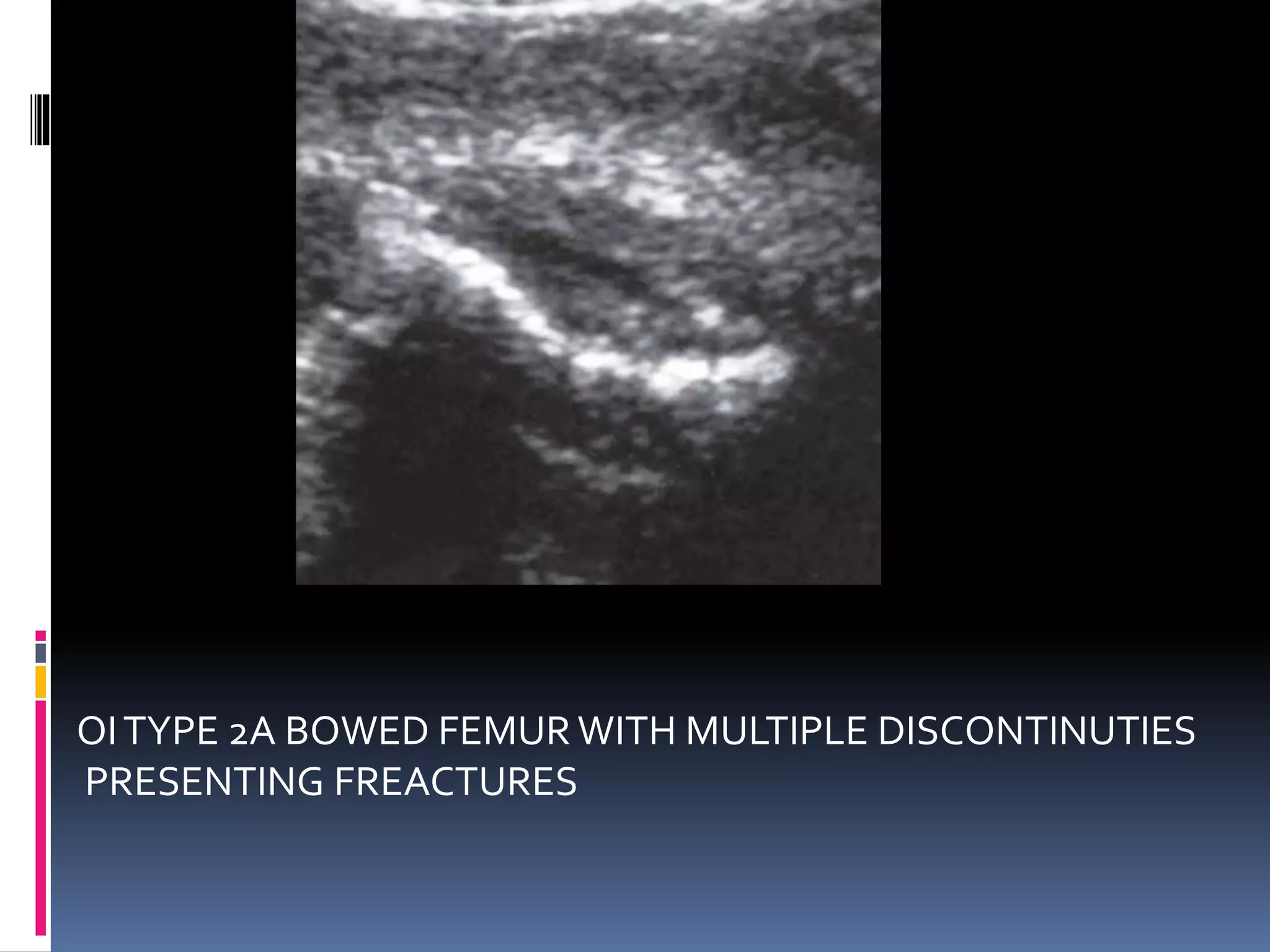 The fetal musculoskeletal system | PPTX