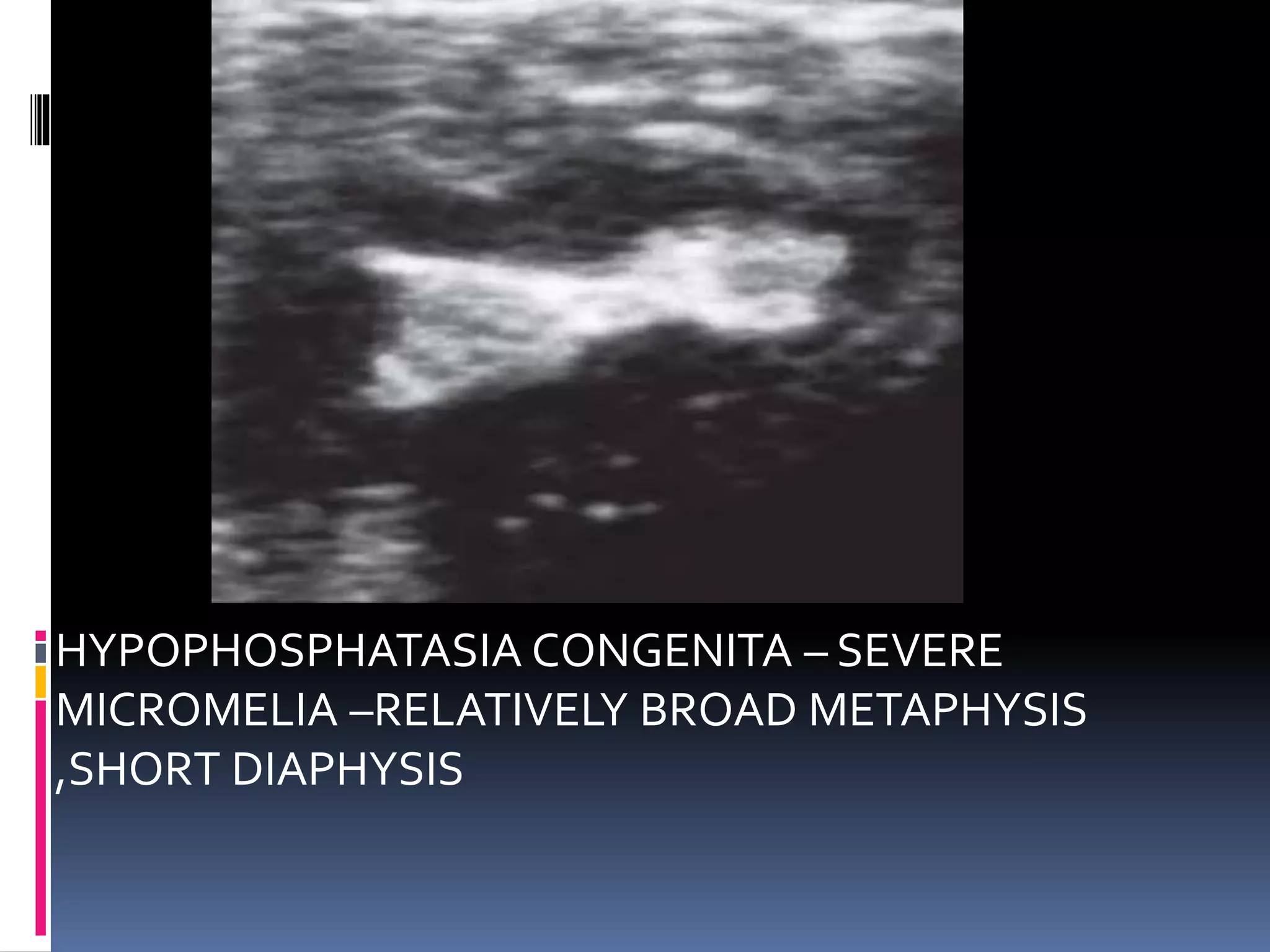 The fetal musculoskeletal system | PPTX