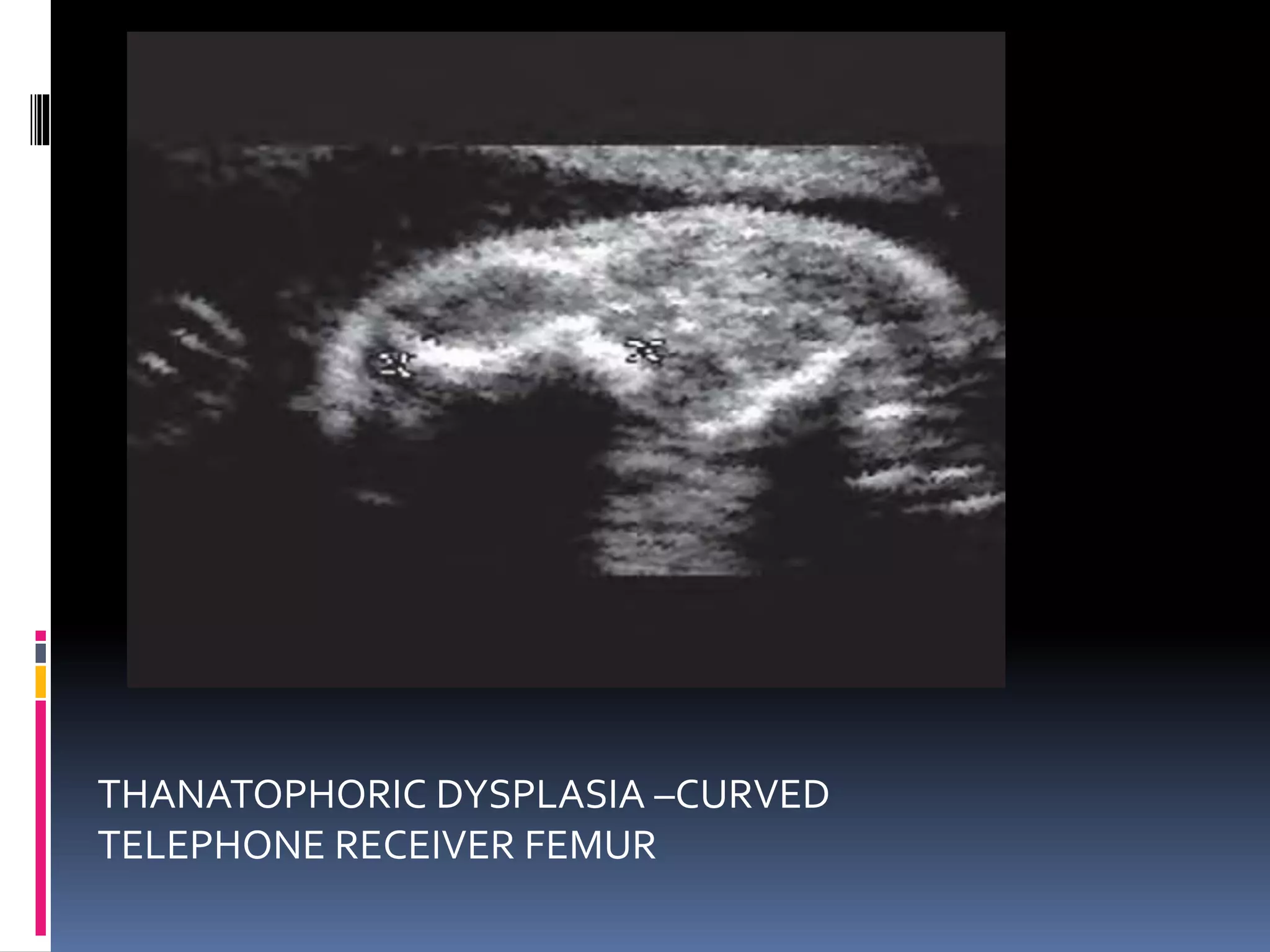 The fetal musculoskeletal system | PPTX