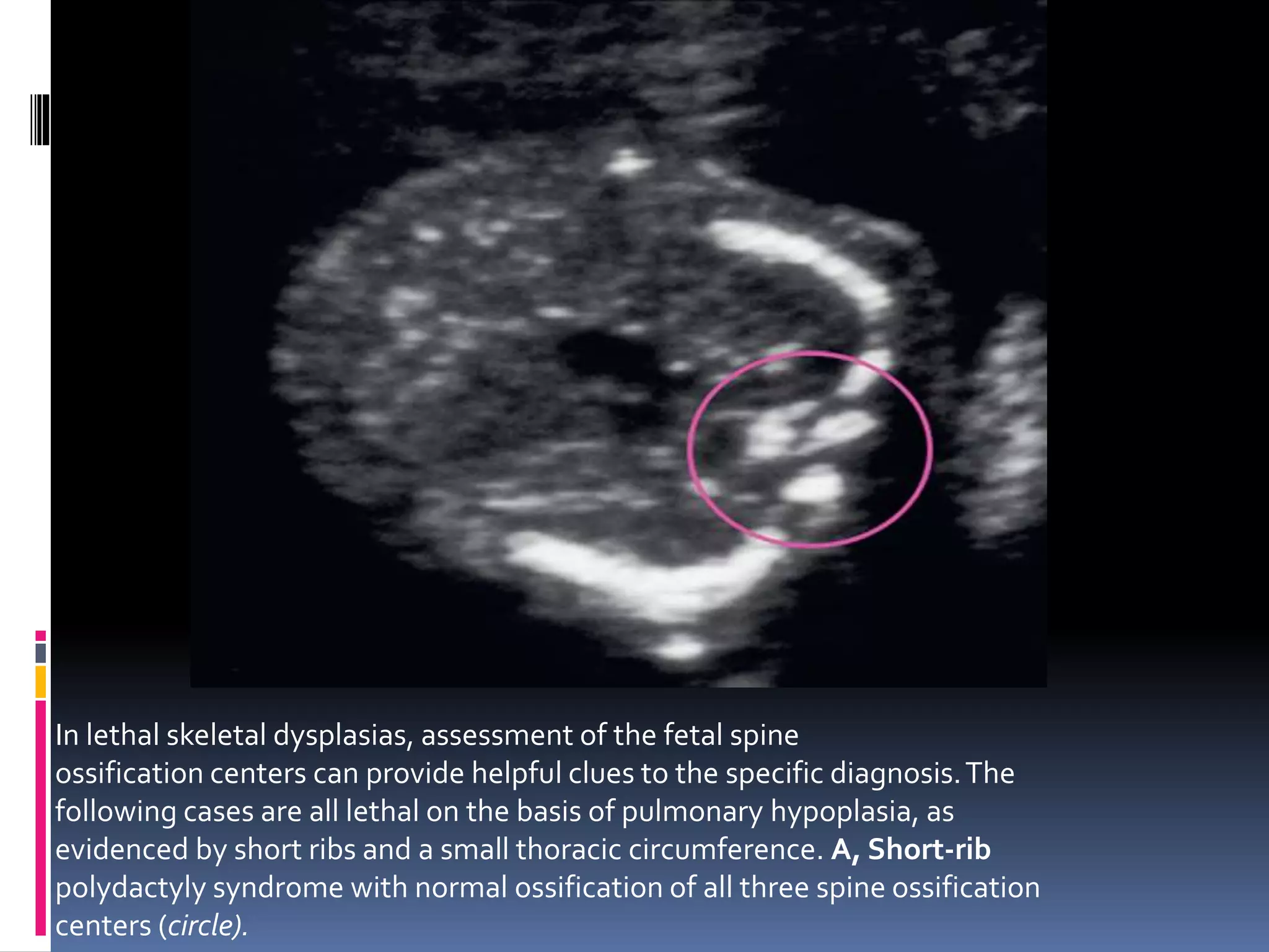 The fetal musculoskeletal system | PPTX
