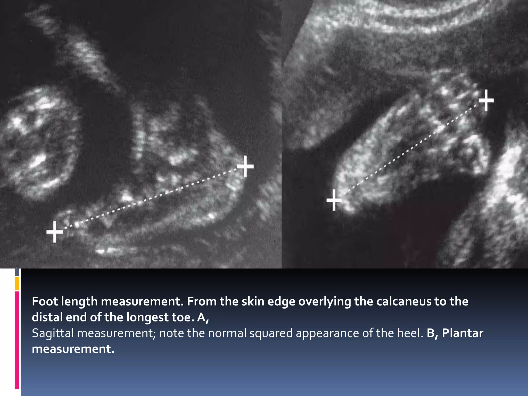 The fetal musculoskeletal system | PPTX