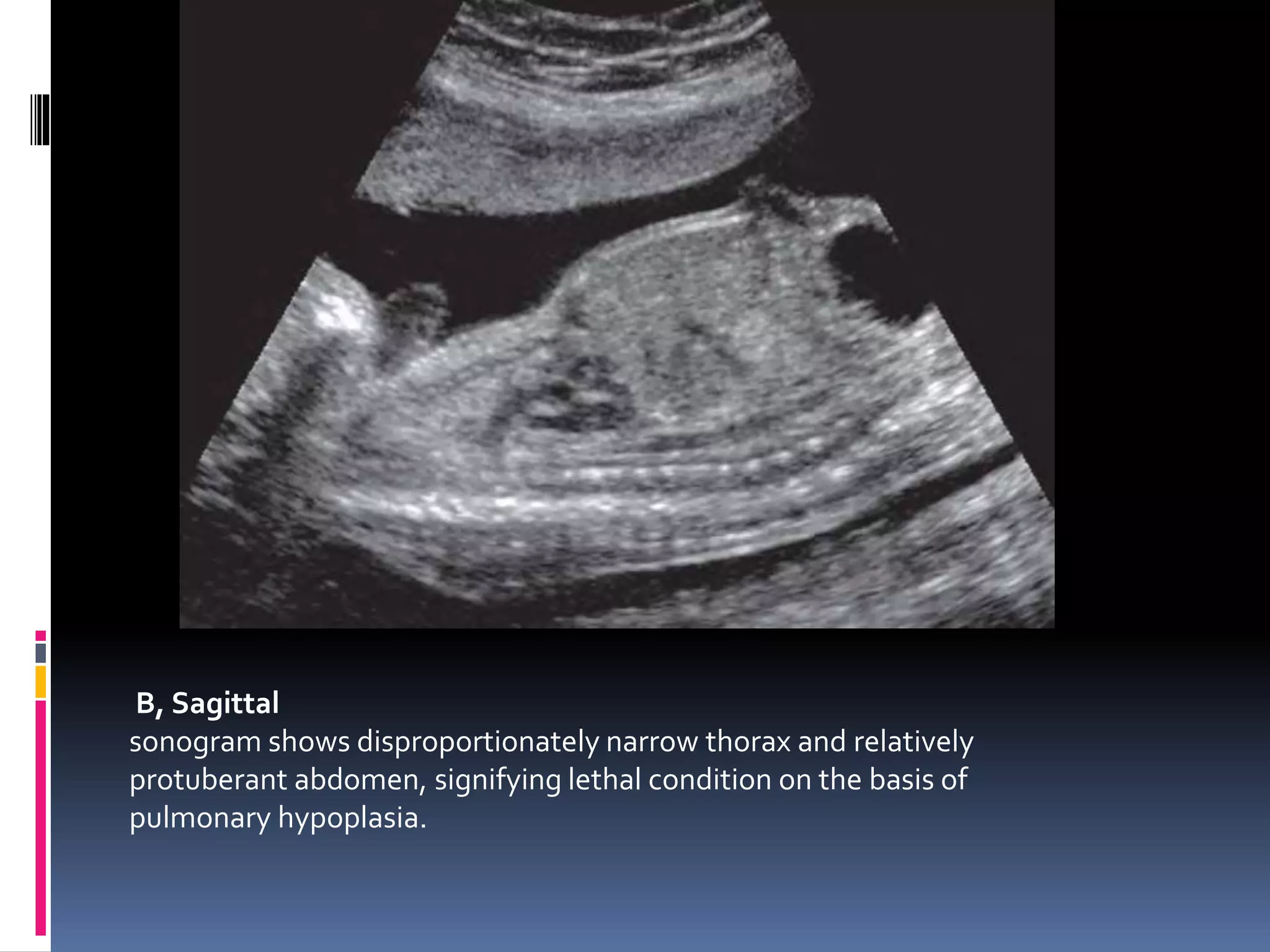 The fetal musculoskeletal system | PPTX
