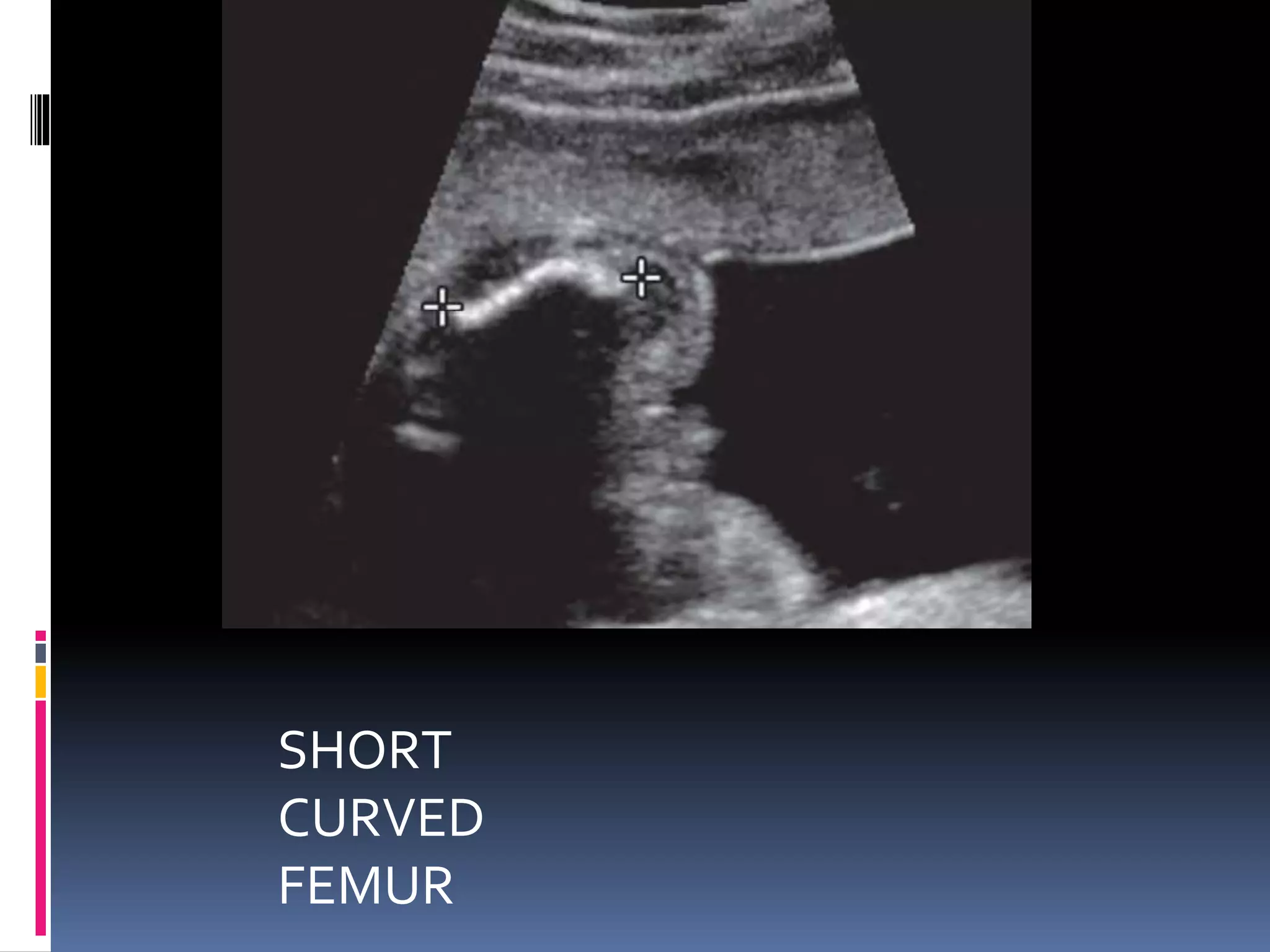 The fetal musculoskeletal system | PPTX