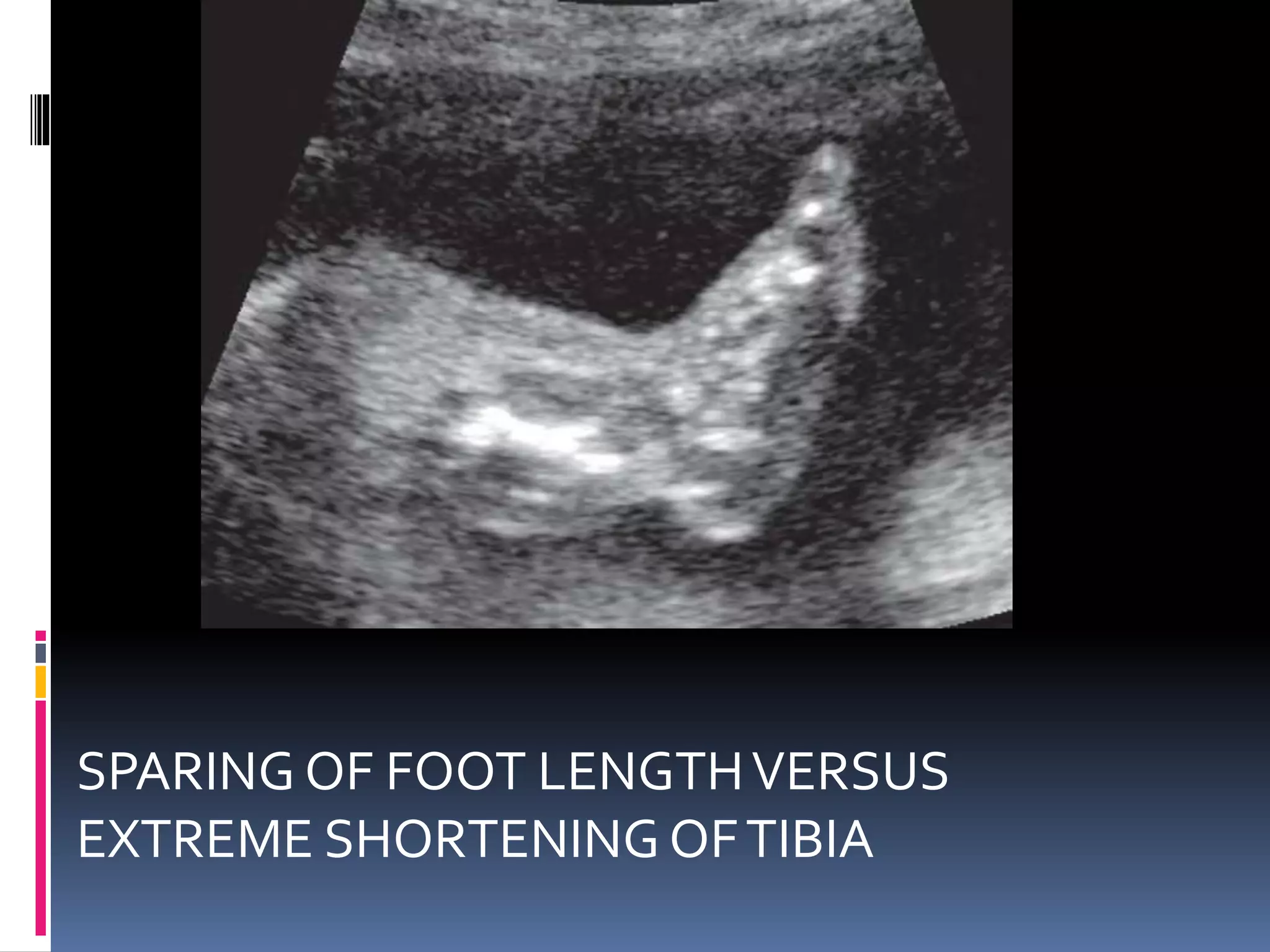 The fetal musculoskeletal system | PPTX