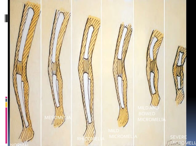 The fetal musculoskeletal system | PPTX | Pregnancy | Reproductive Health