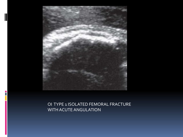 The fetal musculoskeletal system | PPTX | Pregnancy | Reproductive Health