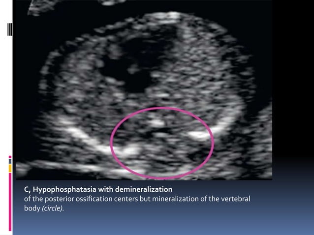 The fetal musculoskeletal system | PPTX | Pregnancy | Reproductive Health