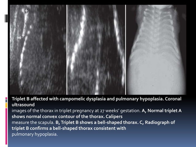 The fetal musculoskeletal system | PPTX | Pregnancy | Reproductive Health