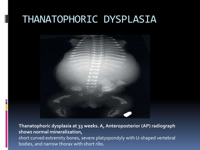 The fetal musculoskeletal system | PPTX | Pregnancy | Reproductive Health