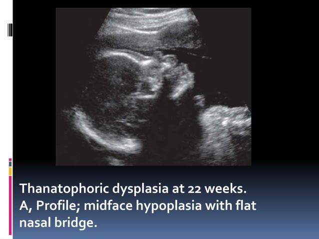 The fetal musculoskeletal system | PPTX | Pregnancy | Reproductive Health