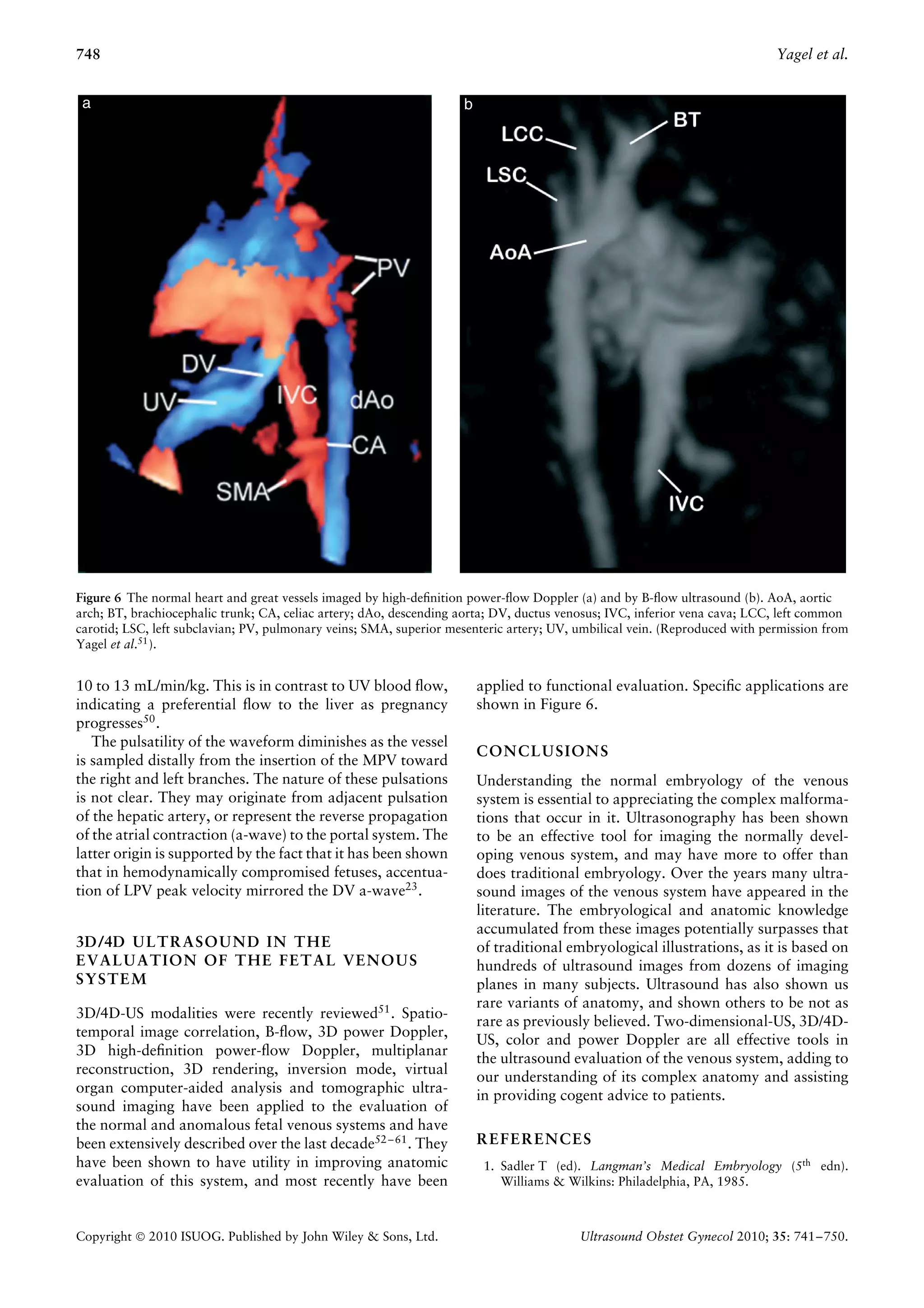 The fetal venous system part i | PDF