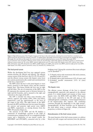 The fetal venous system part i | PDF