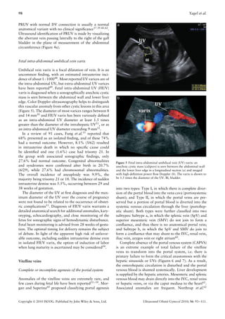 The fetal venous system part ii | PDF