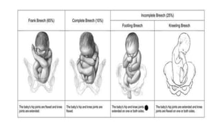 The fetus in-utero ppt | PPTX