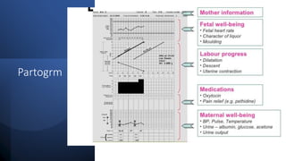 The first stage of labour, poor progression of labour, and augmentation ...