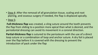 The flap technique for pocket therapy | PPTX