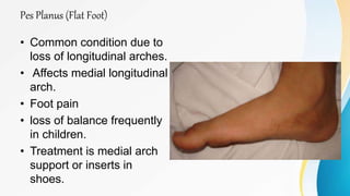 The foot applied anatomy & arches | PPTX