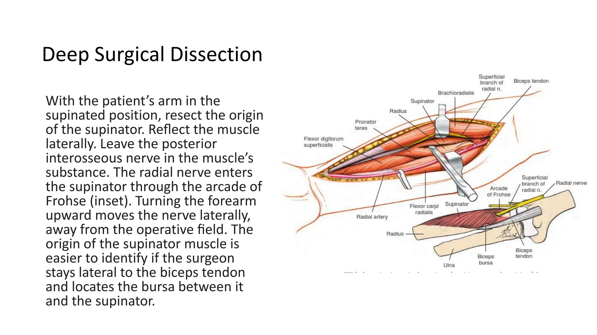 THE FOREARM APPROARCH by Muhammad Nadirsyah | PPTX