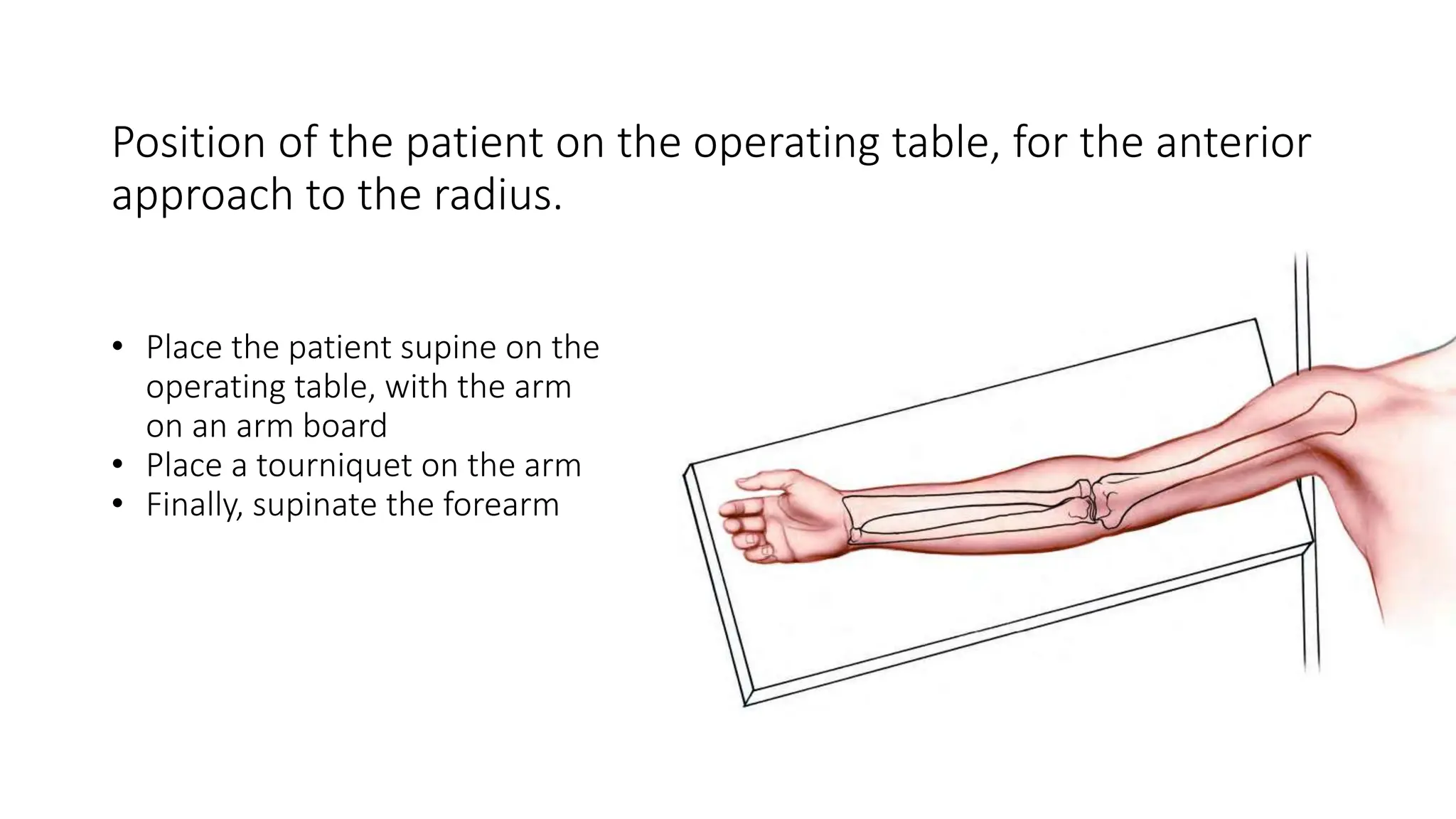 THE FOREARM APPROARCH by Muhammad Nadirsyah | PPTX