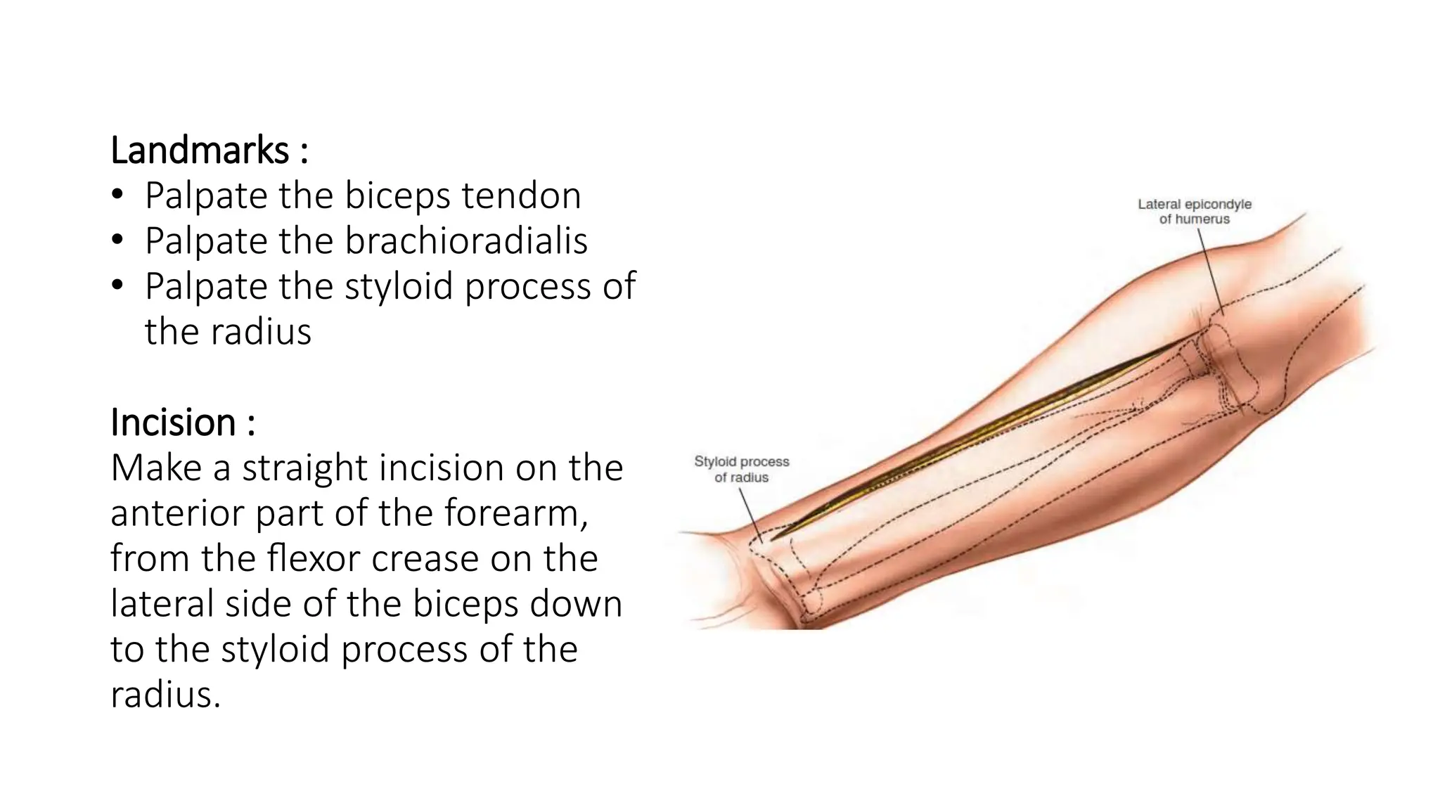 THE FOREARM APPROARCH by Muhammad Nadirsyah | PPTX