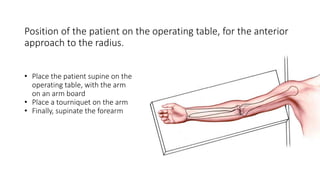 THE FOREARM APPROARCH by Muhammad Nadirsyah | PPTX