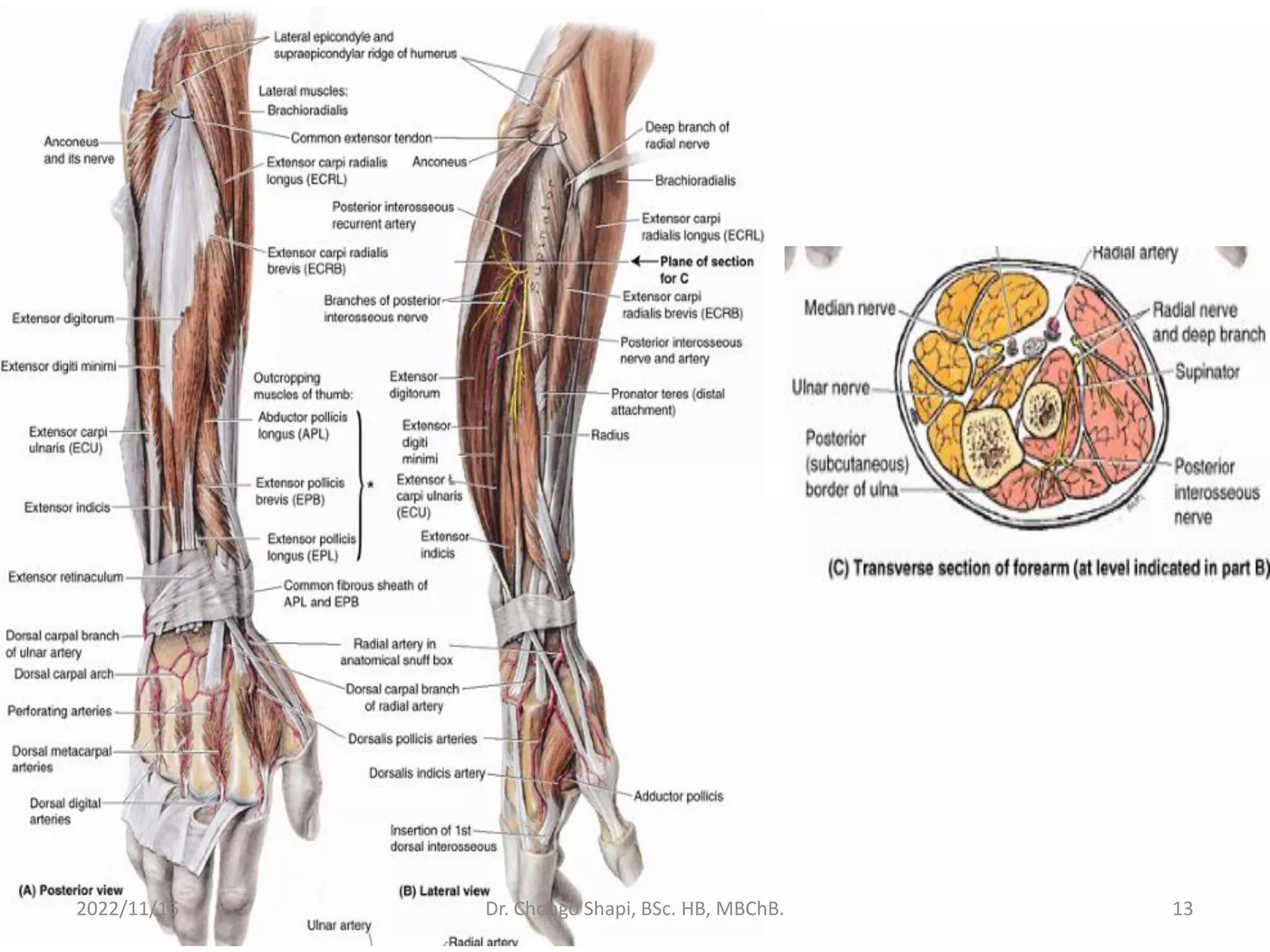 The Forearm by Dr. Shapi.pdf