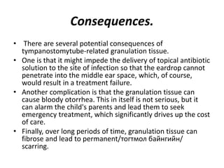 The formation and management of middle ear granulation | PPT