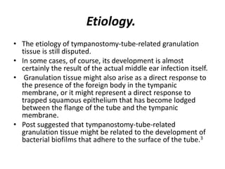 The formation and management of middle ear granulation | PPTX
