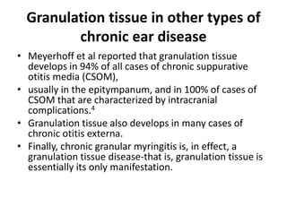 The formation and management of middle ear granulation | PPT