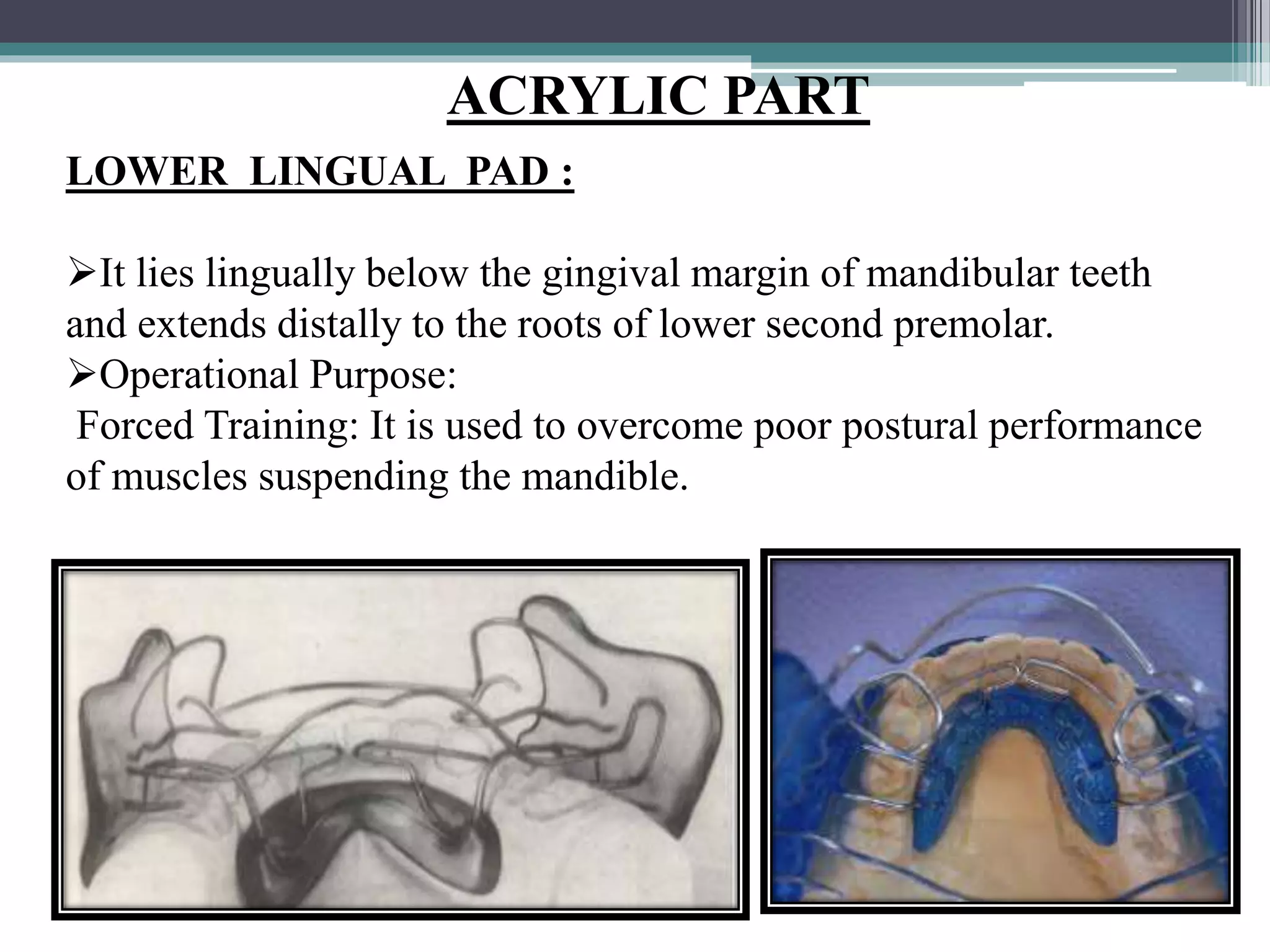 THE FRANKEL FUNCTIONAL REGULATOR.pptx