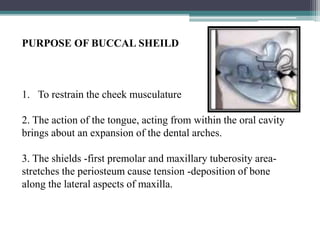 THE FRANKEL FUNCTIONAL REGULATOR.pptx