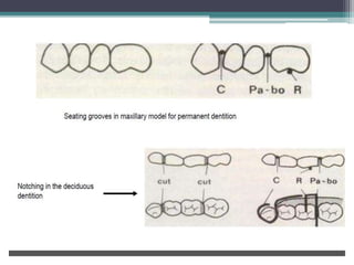 THE FRANKEL FUNCTIONAL REGULATOR.pptx