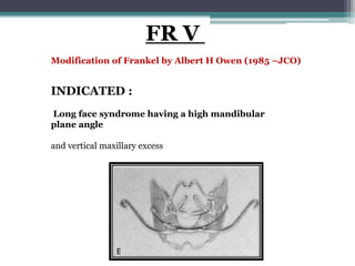 THE FRANKEL FUNCTIONAL REGULATOR.pptx
