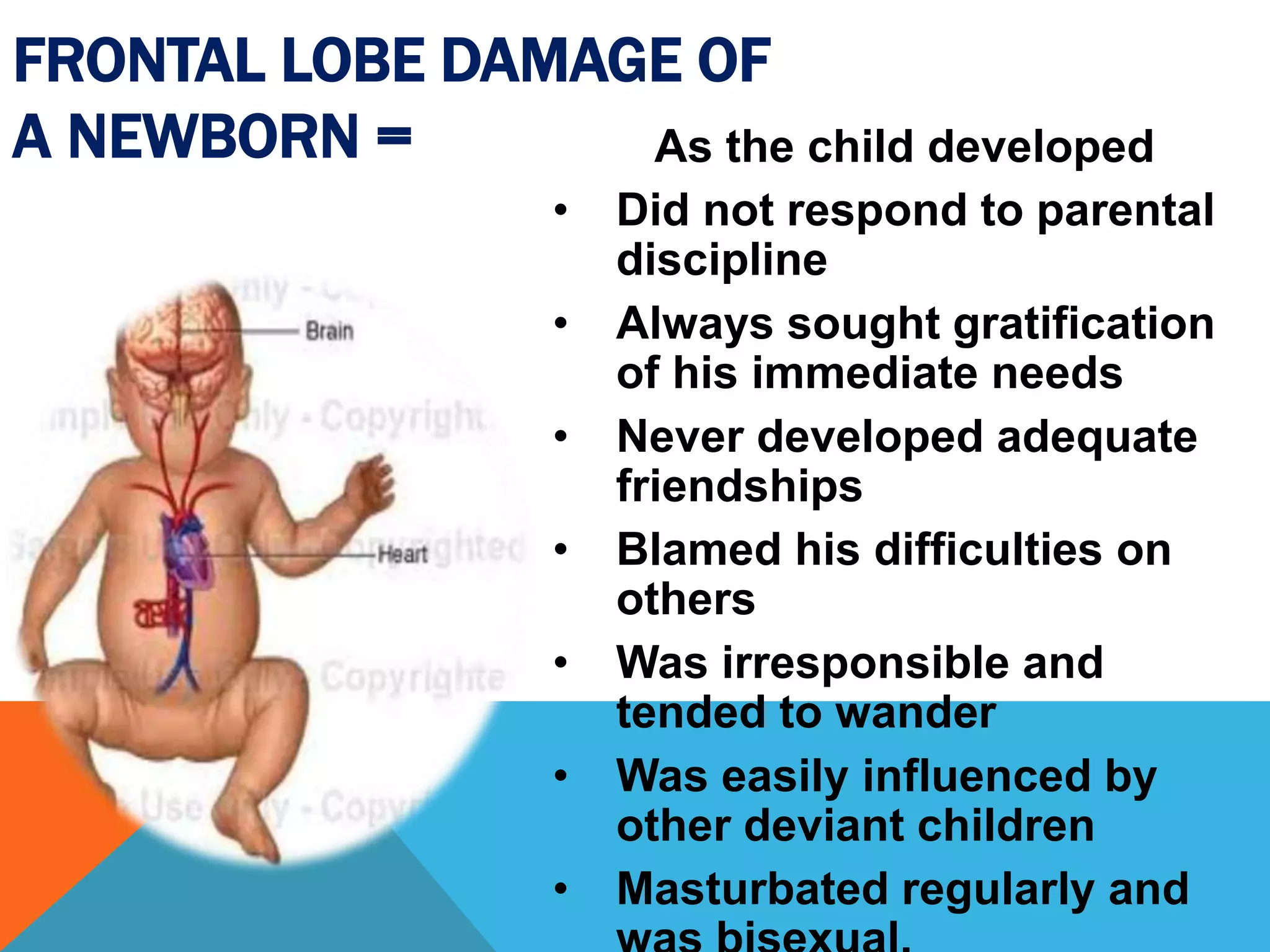 The frontal lobe and sins effects | PPTX | Brain and Nervous System ...