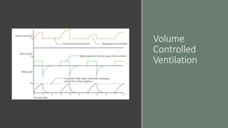 The fundamentals of mechanical ventilation | PPTX