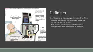 The fundamentals of mechanical ventilation | PPTX