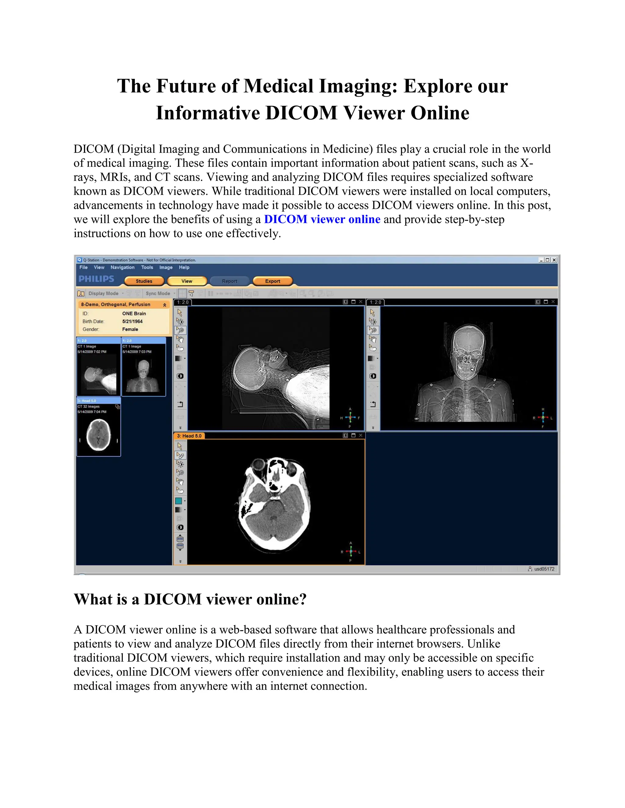 The Future of Medical Imaging Explore our Informative DICOM Viewer Online.pdf