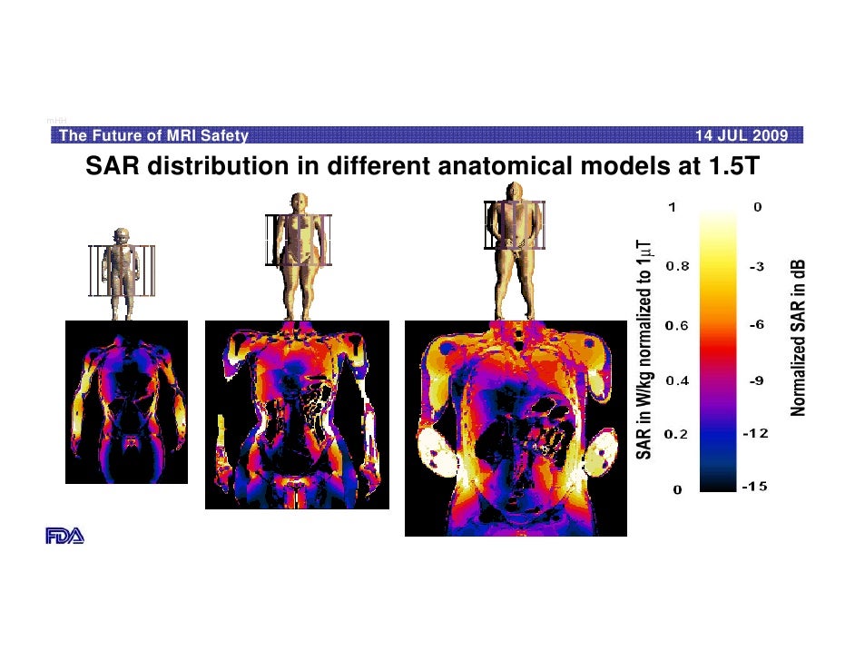 The Future Of Mri Safety W Kainz 13 Jul2009