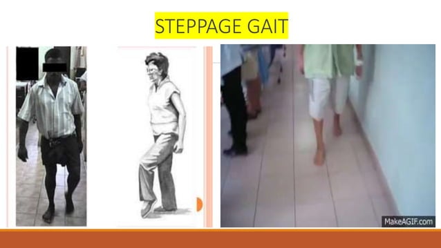 the gait.pptx