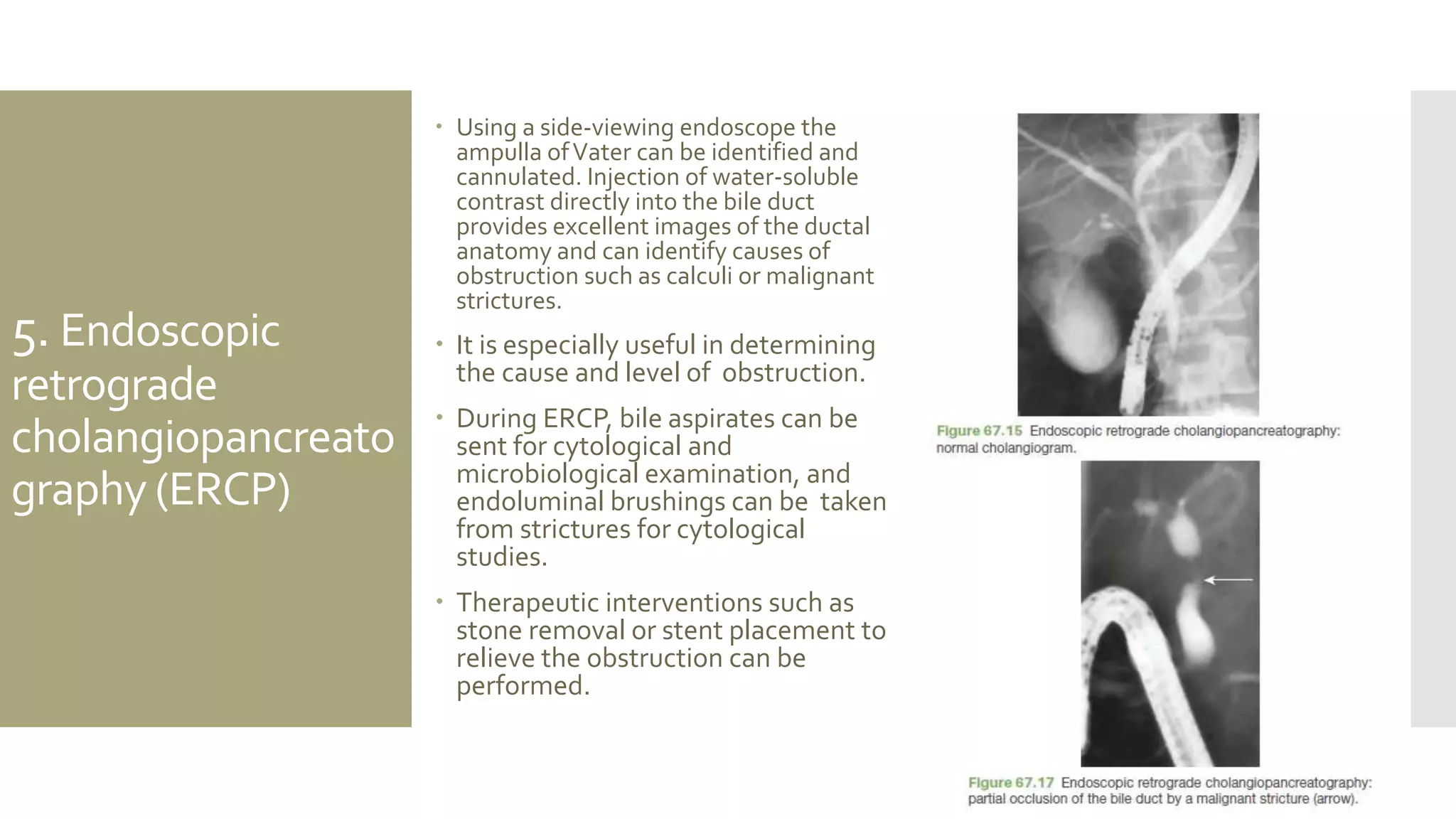 The gallbladder and bile ducts | PPTX