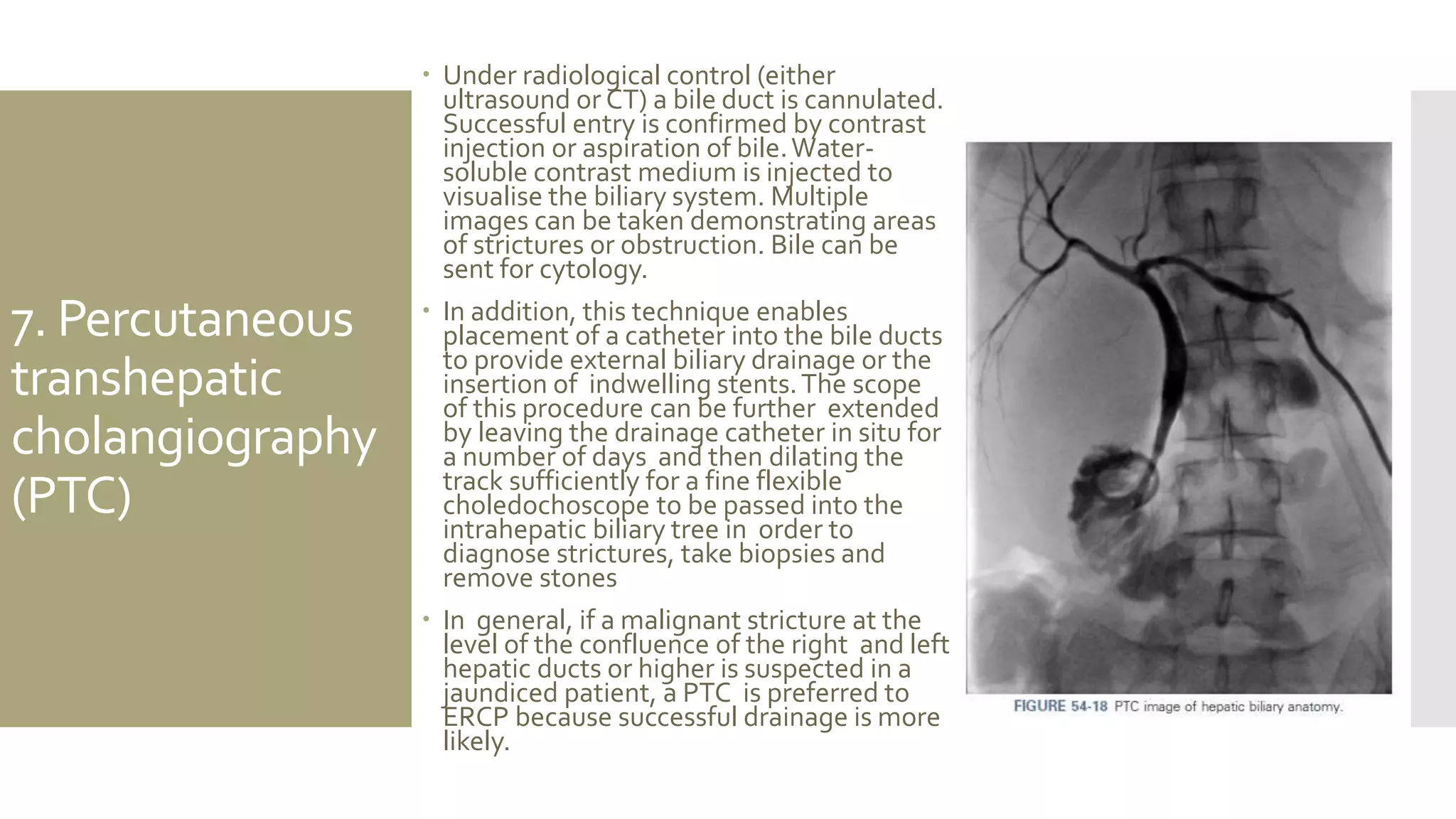 The gallbladder and bile ducts | PPTX