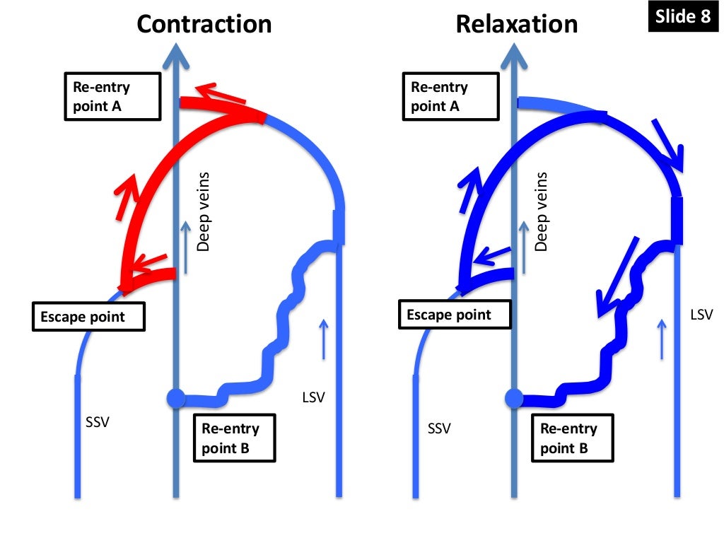 The giacomini vein and its pathological flows ( Phoenix, ACP annual m…