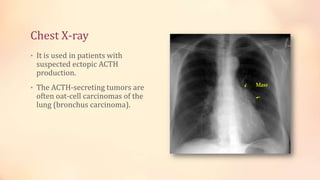 Cushing's syndrome | PPTX